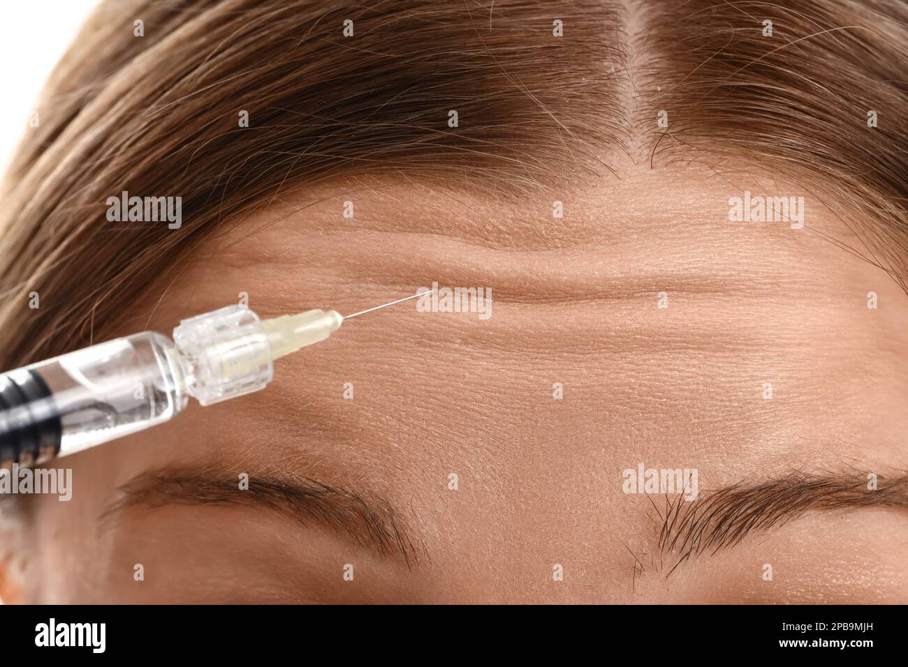 Young woman receiving filler injection in forehead, closeup Stock Photo ...