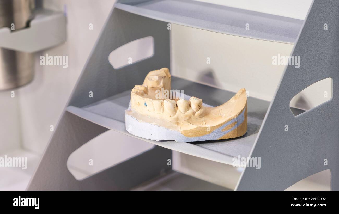 Close-up on plaster model of artificial jaw with teeth. Orthodontic equipment. Device for ...