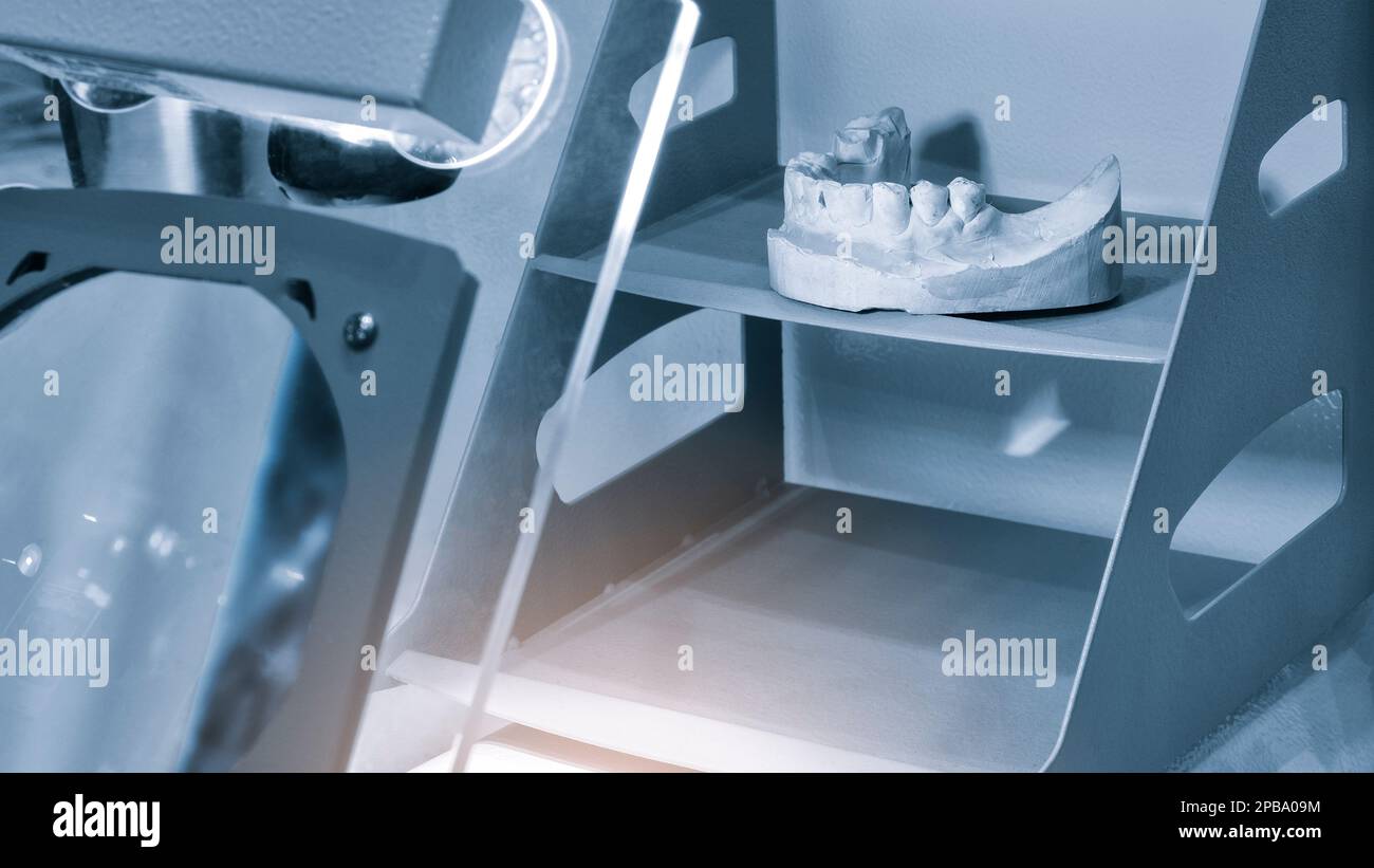 Close-up on plaster model of artificial jaw with teeth. Orthodontic ...