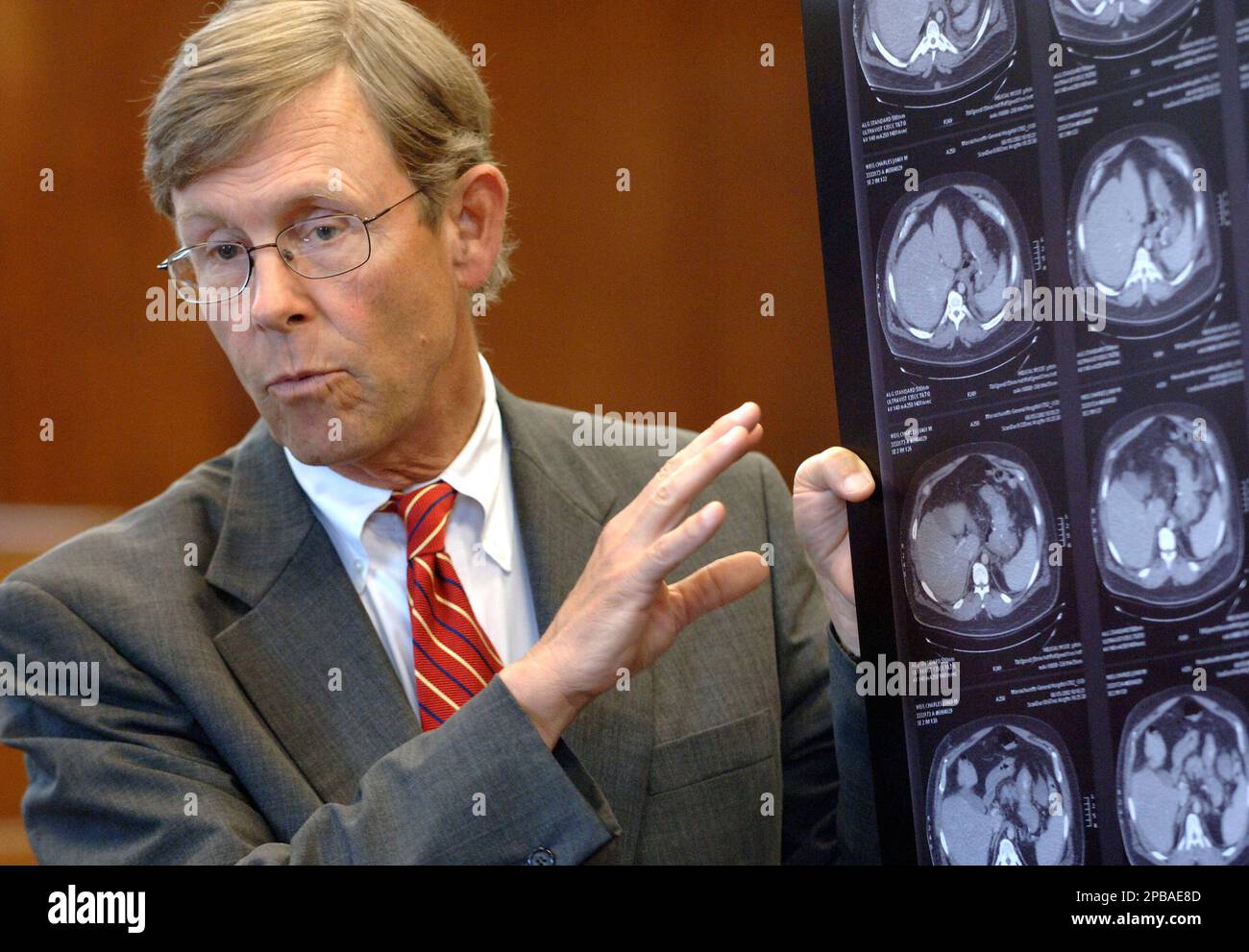 Dr. David Brooks, surgeon at Brigham and Women's Hospital, indicates ...