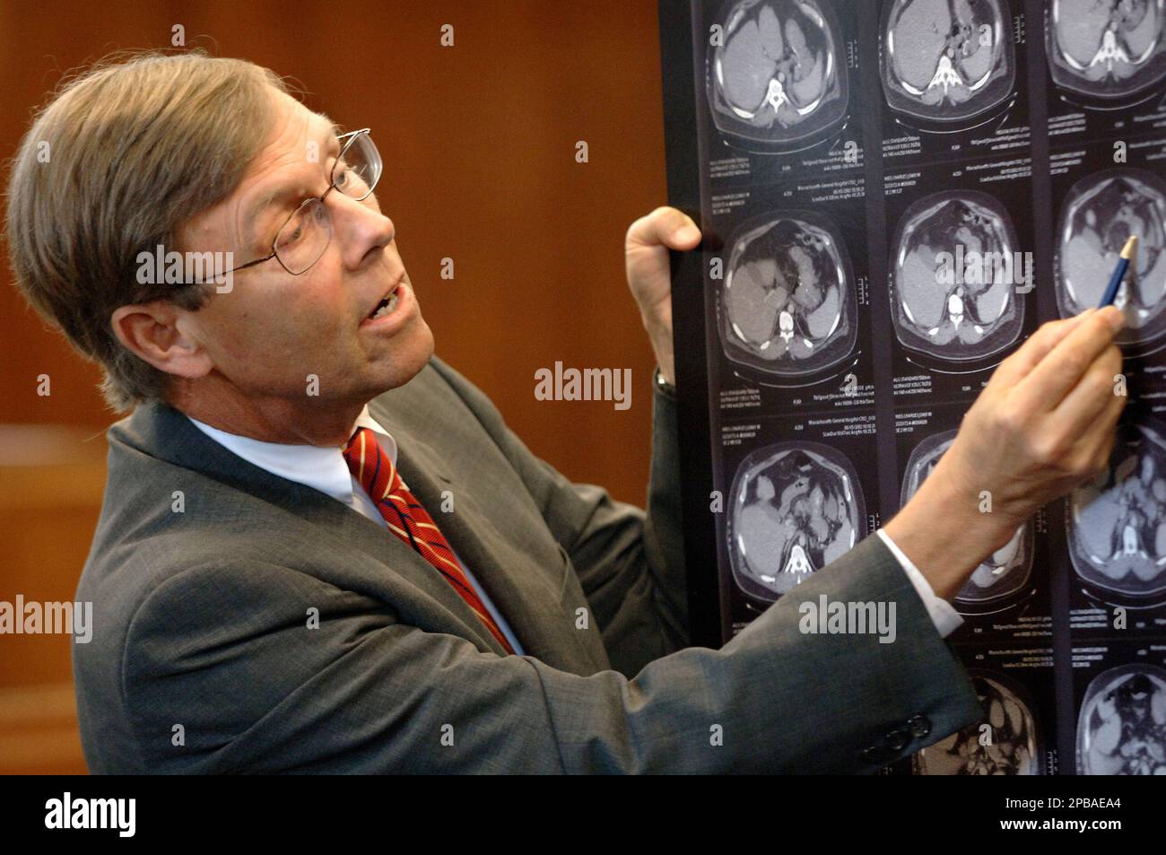 Dr. David Brooks, surgeon at Brigham and Women's Hospital, indicates ...