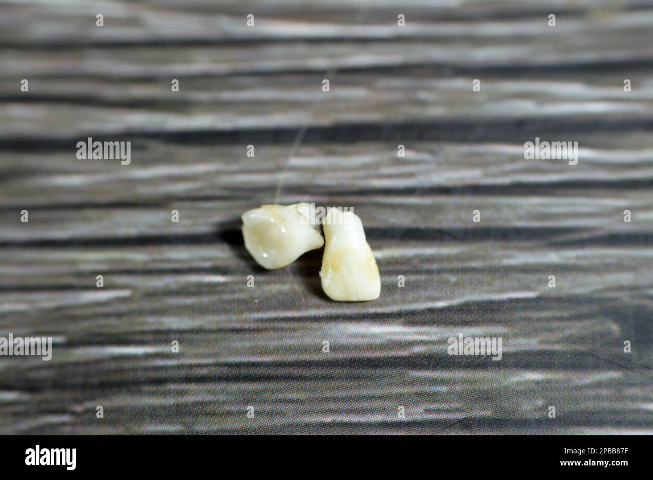 Deciduous primary baby temporary teeth, the first set of teeth in the ...