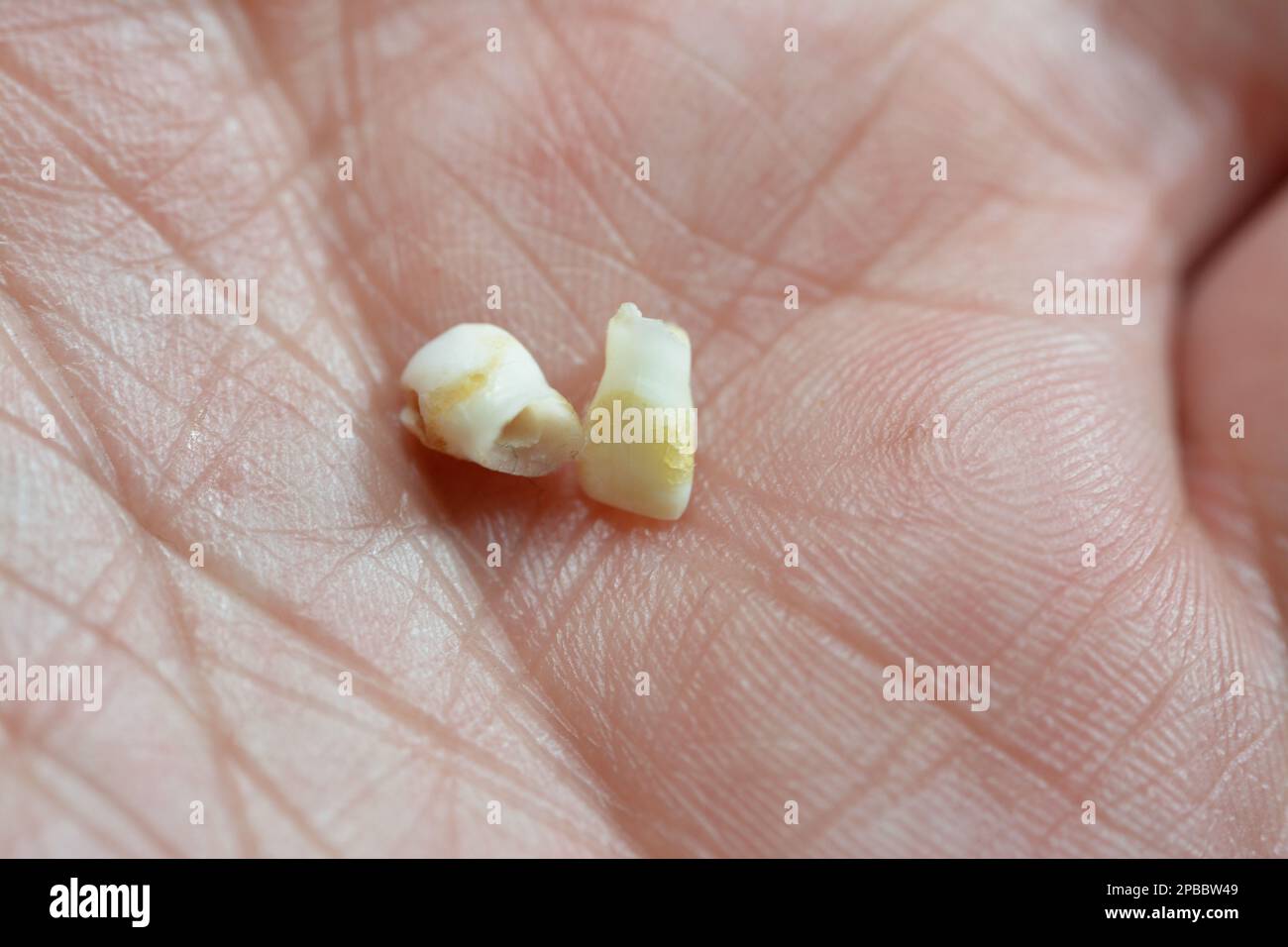Temporary to permanent hi-res stock photography and images - Alamy