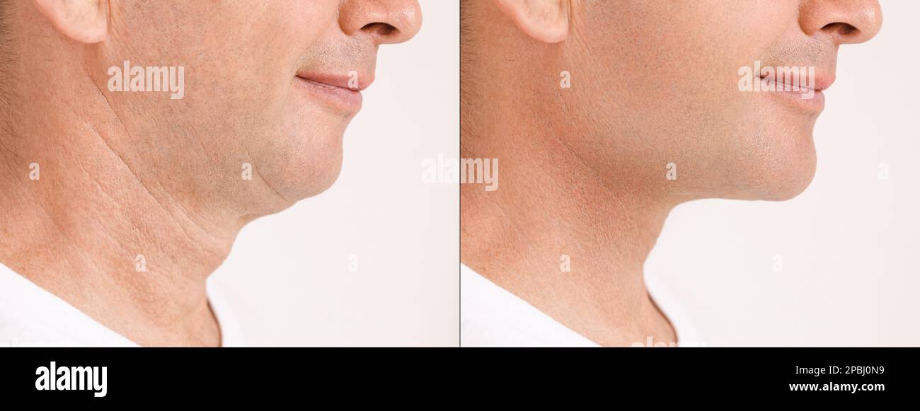 A close portrait of an aged woman before and after the facial ...