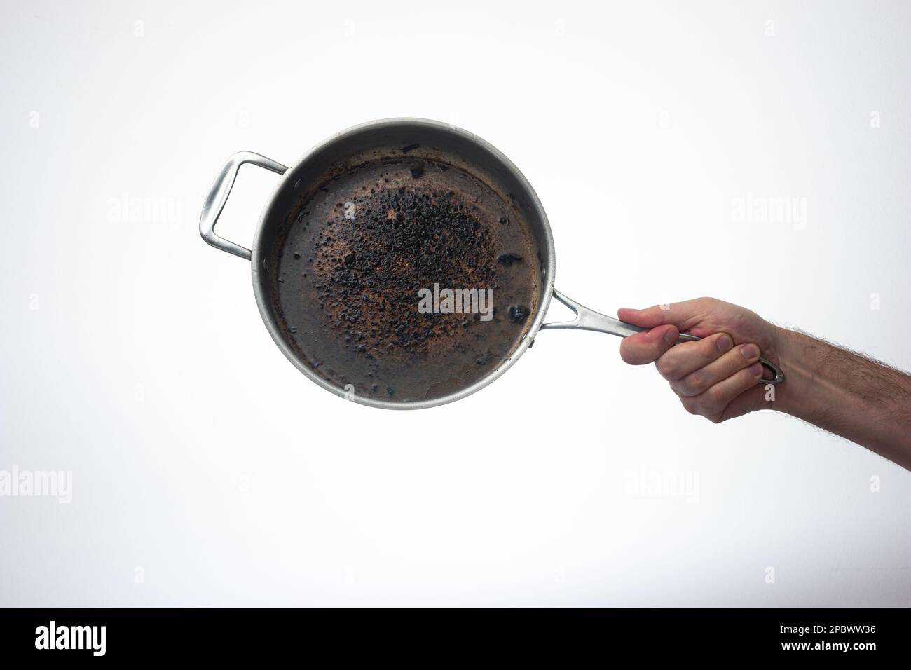 Burn mark on hand hi-res stock photography and images - Alamy