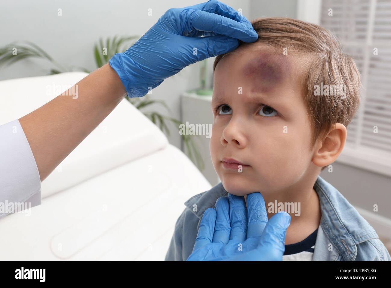 Nurse bruise face hi-res stock photography and images - Alamy