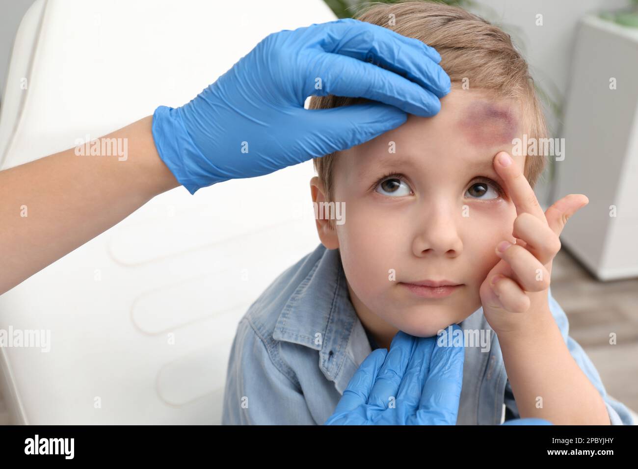 Nurse bruise face hi-res stock photography and images - Alamy