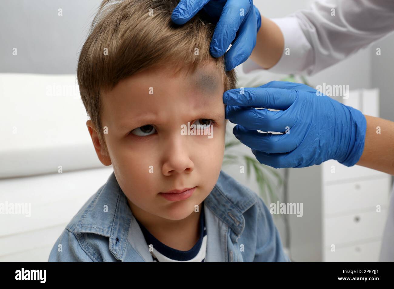 Nurse bruise face hi-res stock photography and images - Alamy