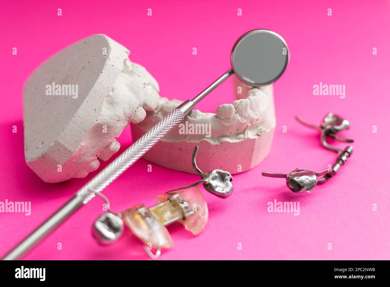 Dental models top view. Jaw models with different problems. Treatment ...