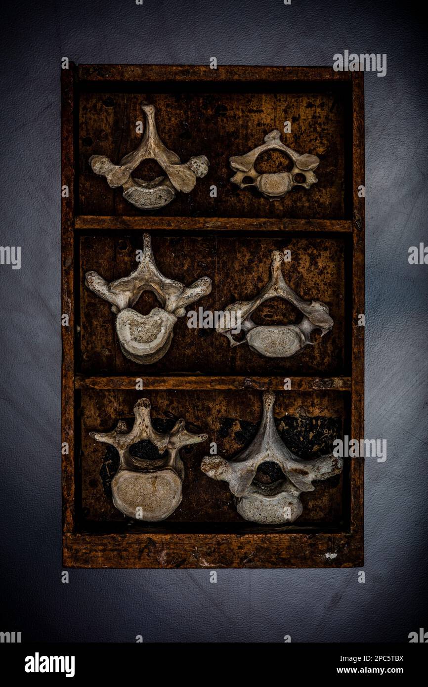 Human vertebrae hi-res stock photography and images - Alamy