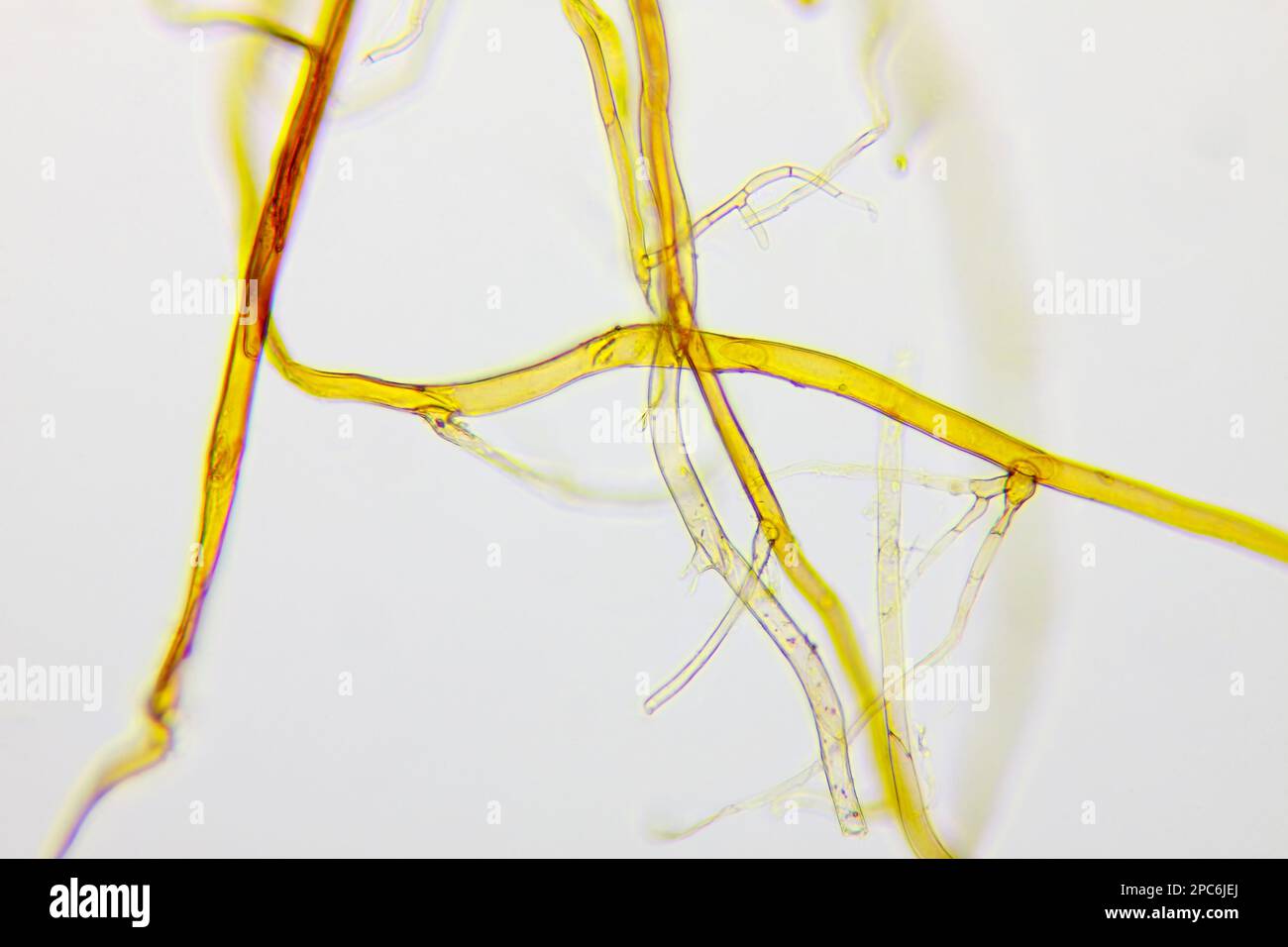 Microscopic view of moss rhizoids. Brightfield illumination Stock Photo ...