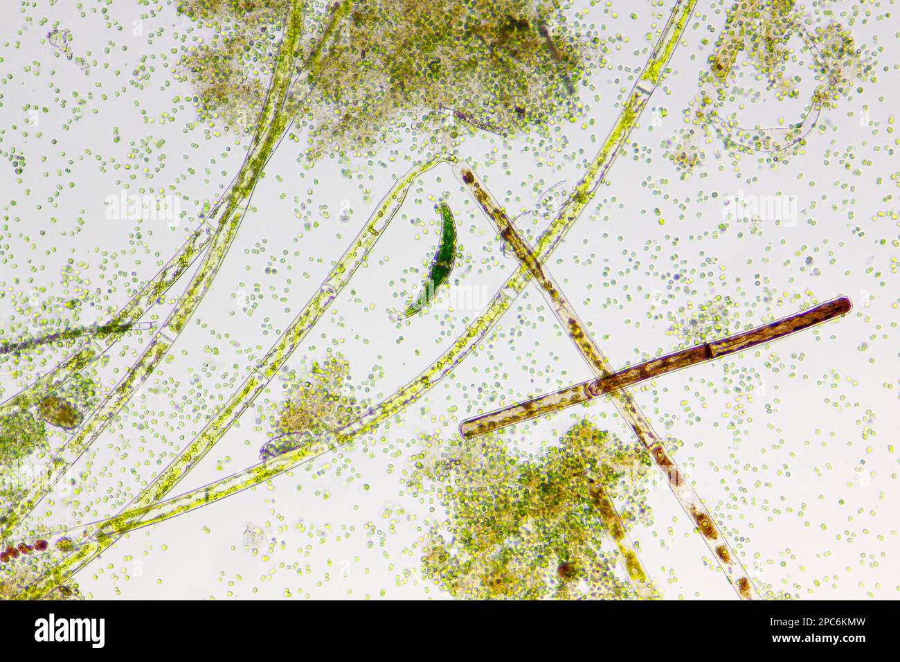 Microscopic view of detritus with various species of freshwater algae ...