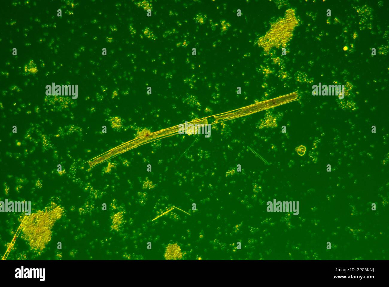 Microscopic view of various species of planktonic freshwater algae ...