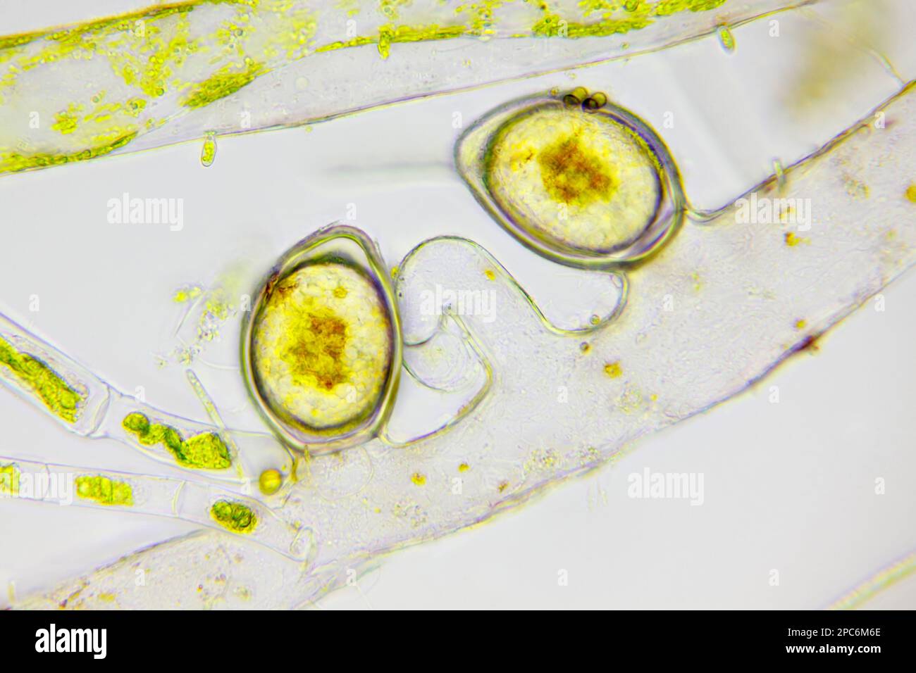 Microscopic view of freshwater algae filament at propagation stage ...