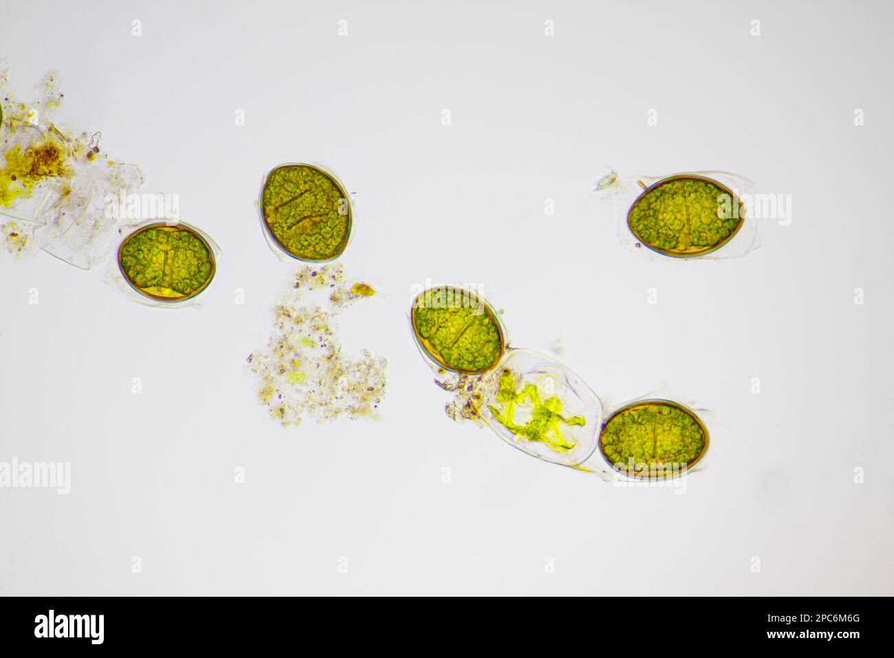 Microscopic view of freshwater green algae (Spirogyra) zygospores ...