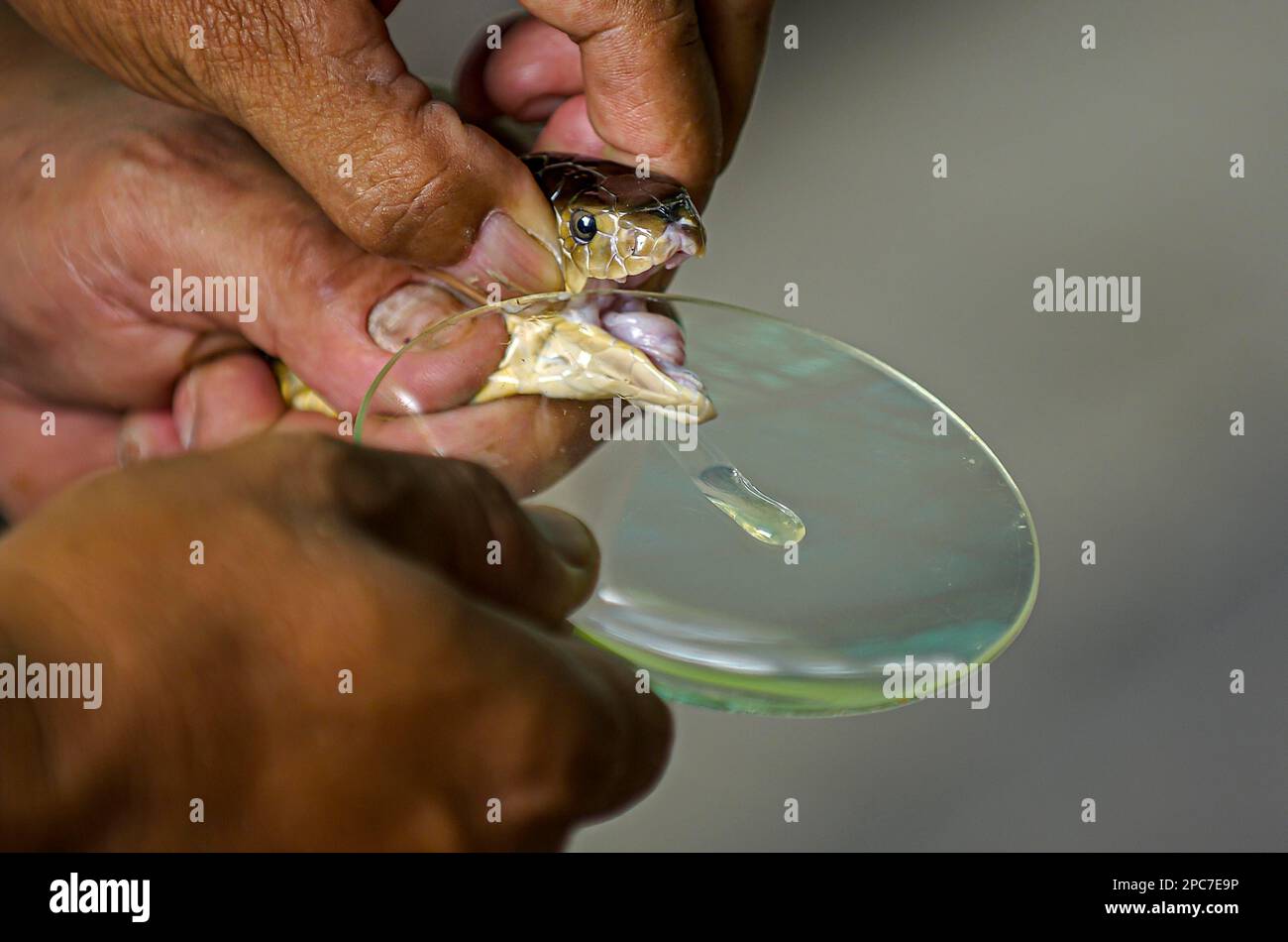 Venom removal hi-res stock photography and images - Alamy