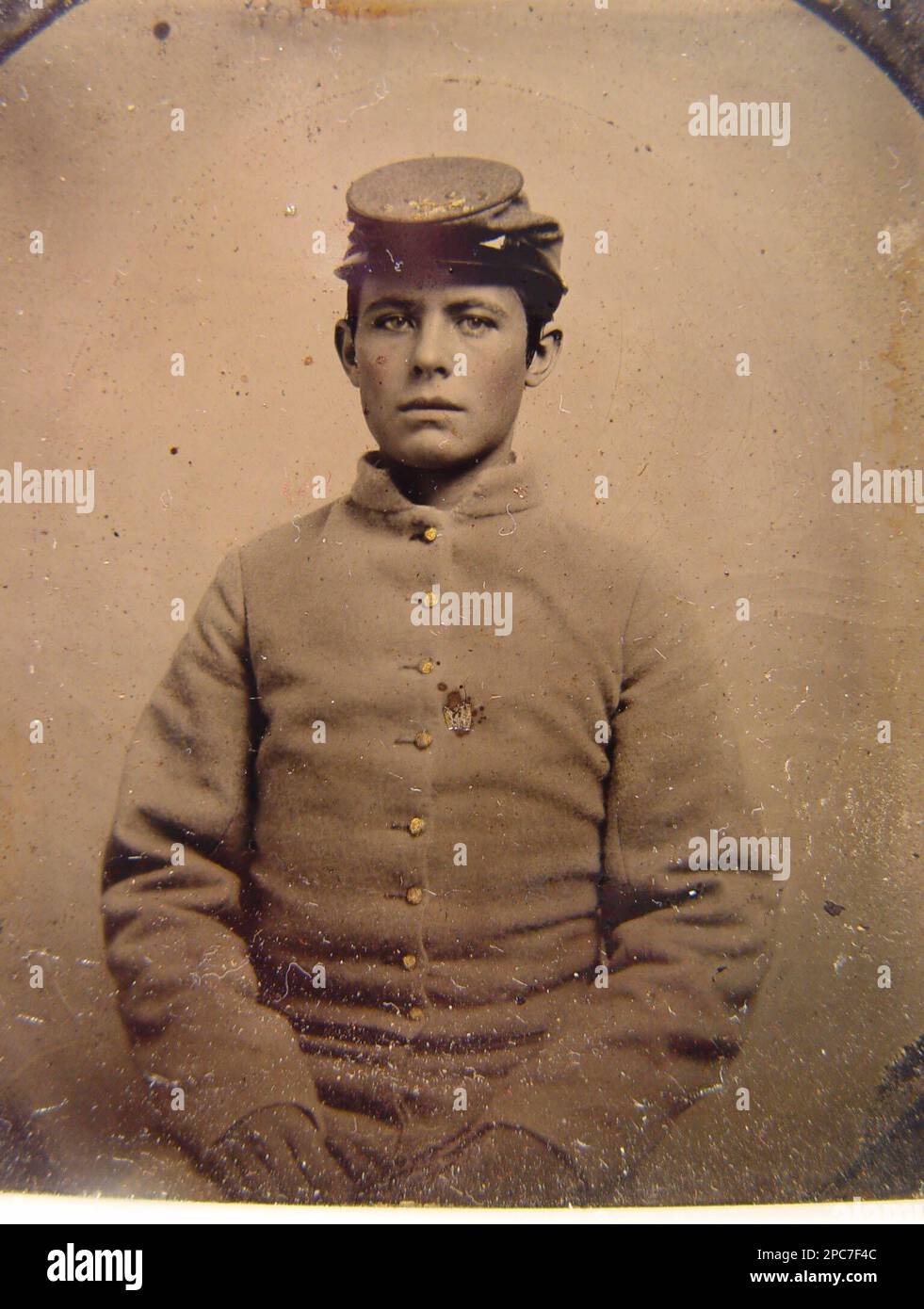 Unidentified young soldier in Confederate shell jacket and artillery ...