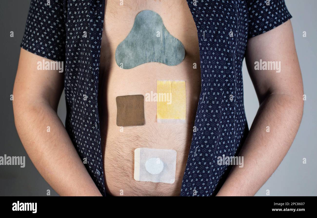 Various medical plasters are glued on the human body. Plaster from ...