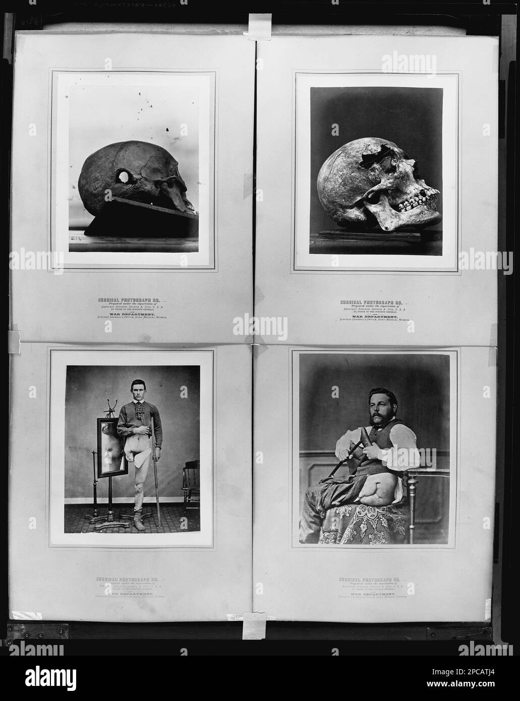 Surgical photograph ... prepared under the supervision of ... War ...