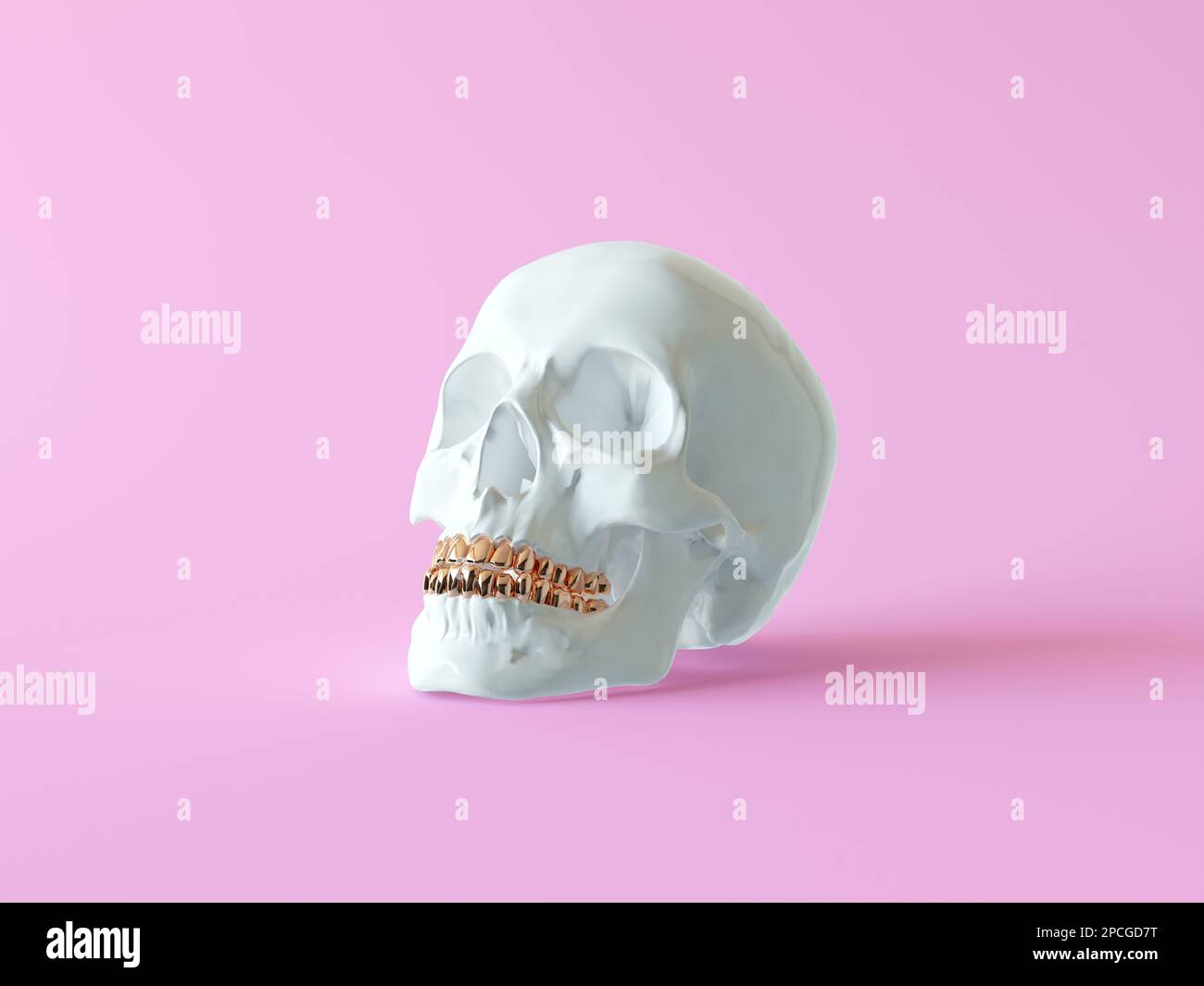 A white anatomical skull with gold metal false teeth and a jaw ...