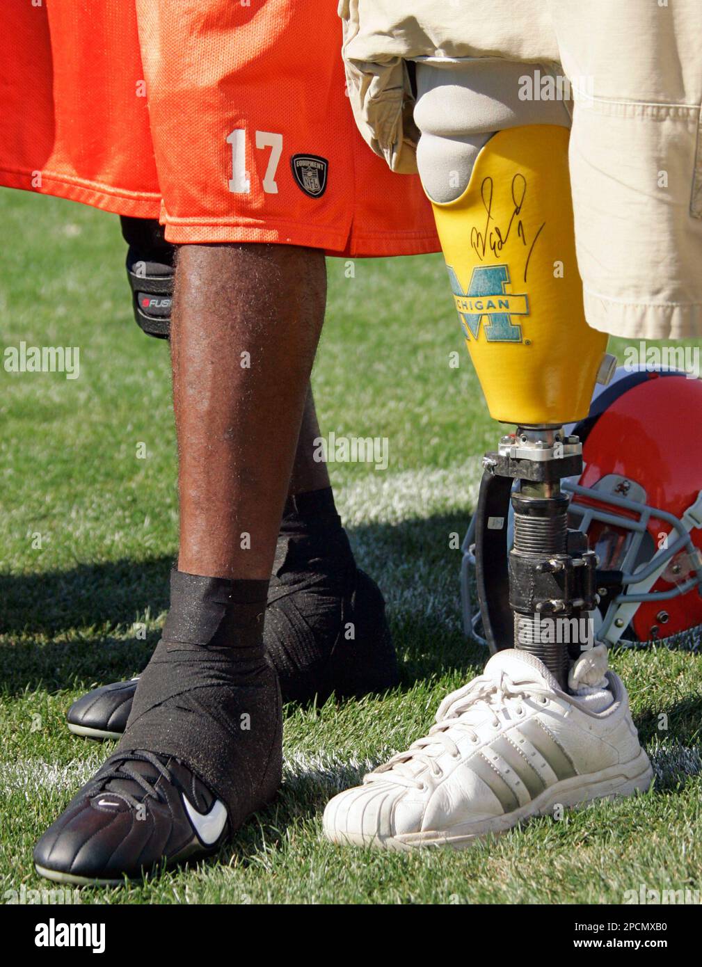 The prosthetic leg of Army Spc. Terry Dean of Hillsboro, Ohio sports a ...