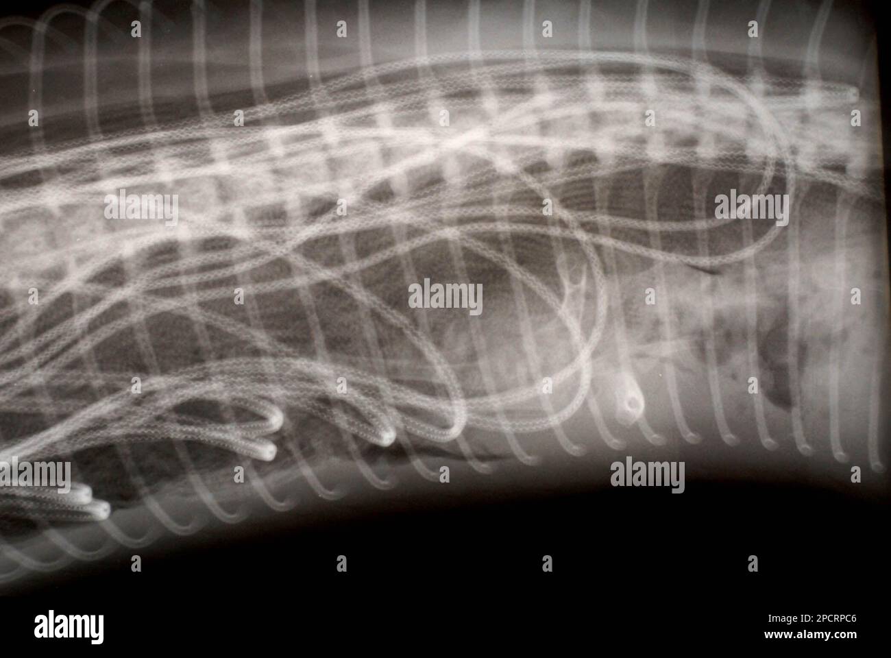A pre-surgery X-ray of Houdini, a 12-foot (3.6-meter) Burmese python ...