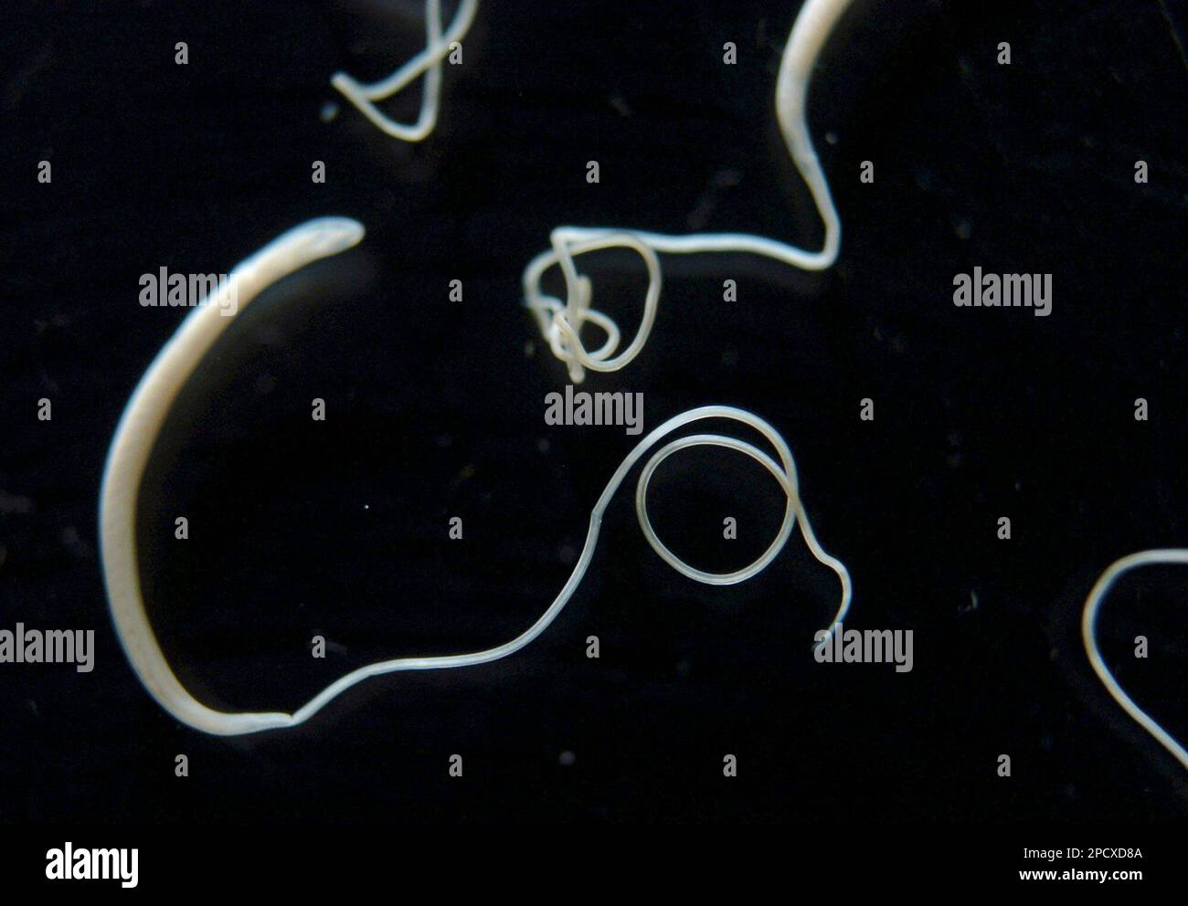 ** FILE ** Whipworms are shown in the lab of professor of microbiology ...