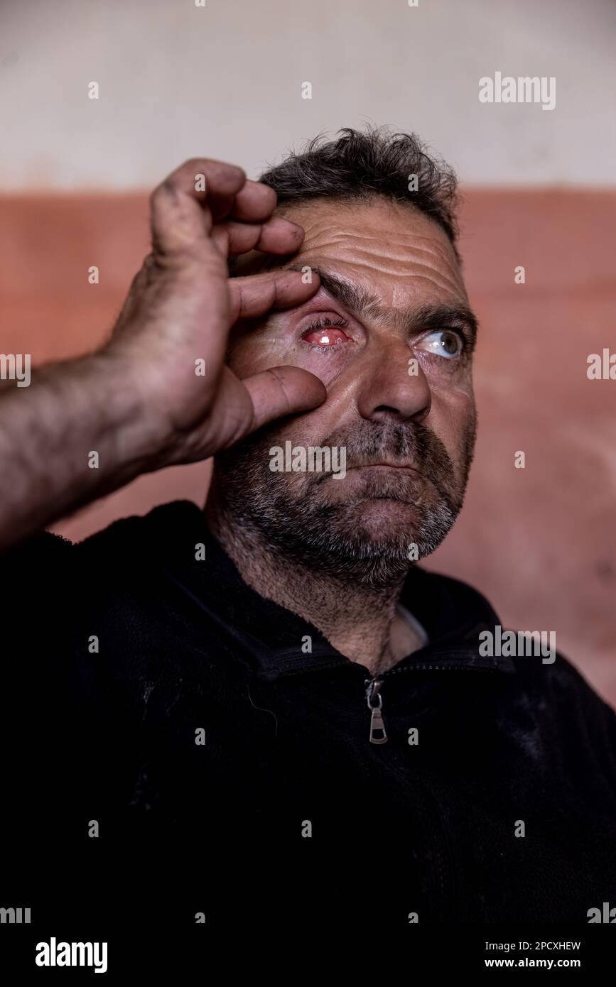 Mashhad Ruhin, Syria. 14th Mar, 2023. Ibrahim Serjawi, 47, shows the ...