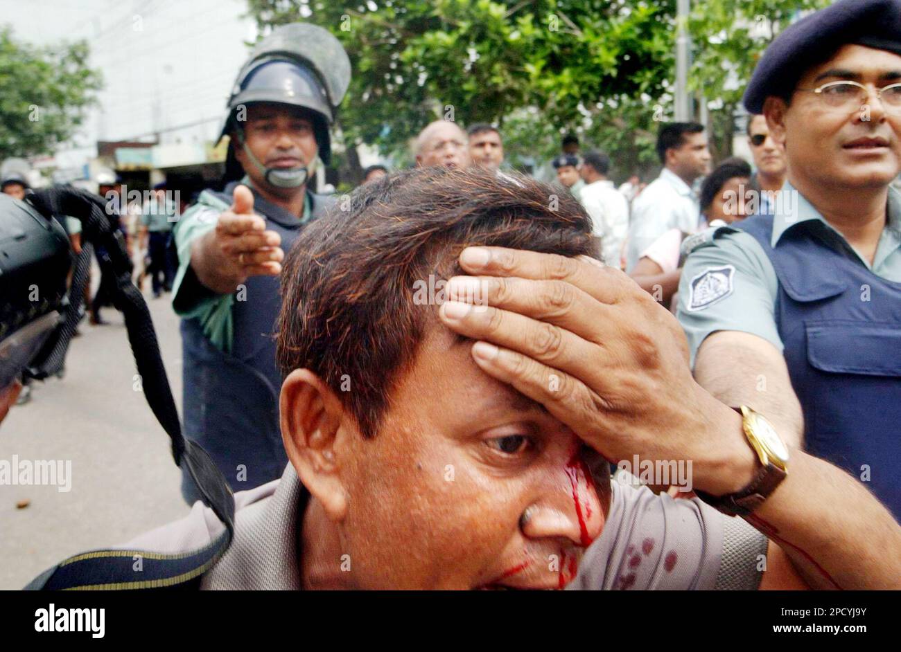 Police Batons Injuries