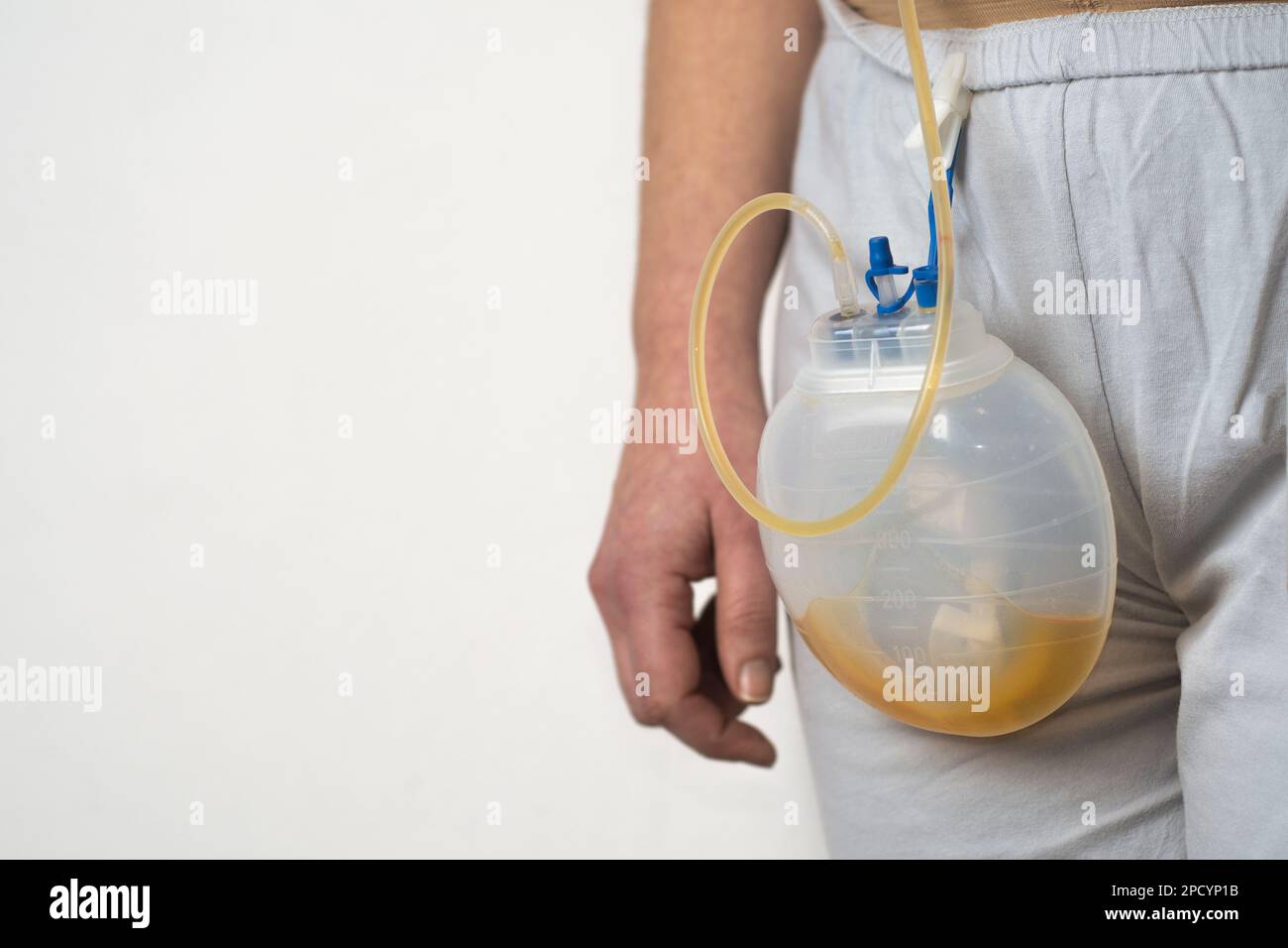 Serous Fluid Drainage