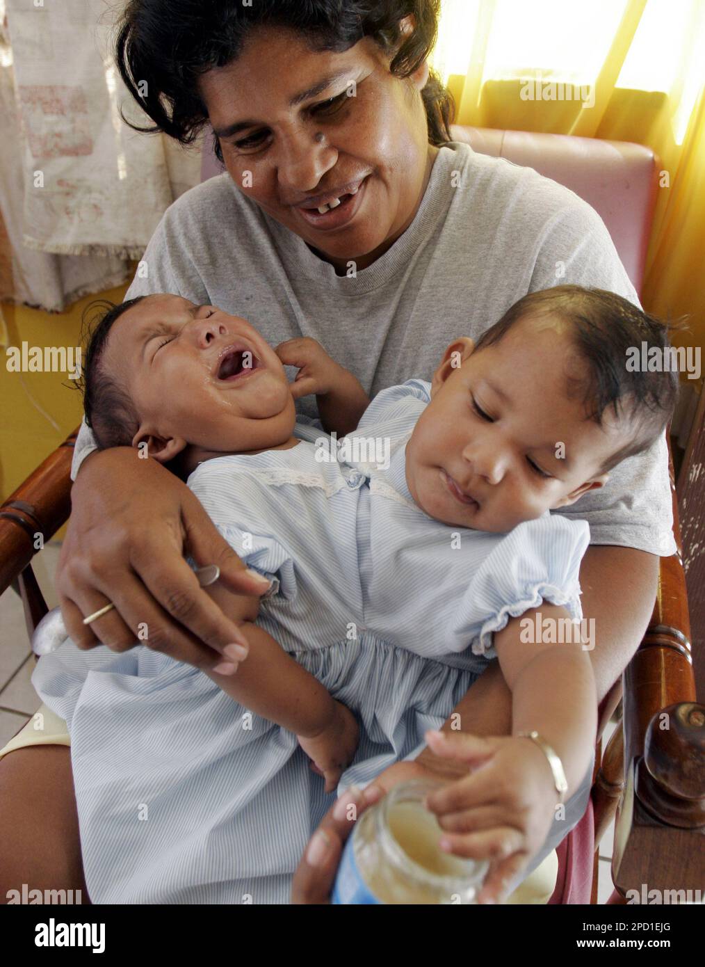 Nicaraguan Maria Elizabeth Arias holds her siamese twin daughters ...