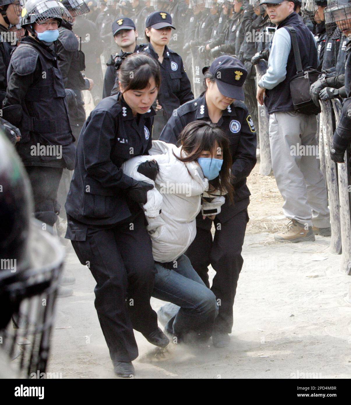 Police Batons Injuries