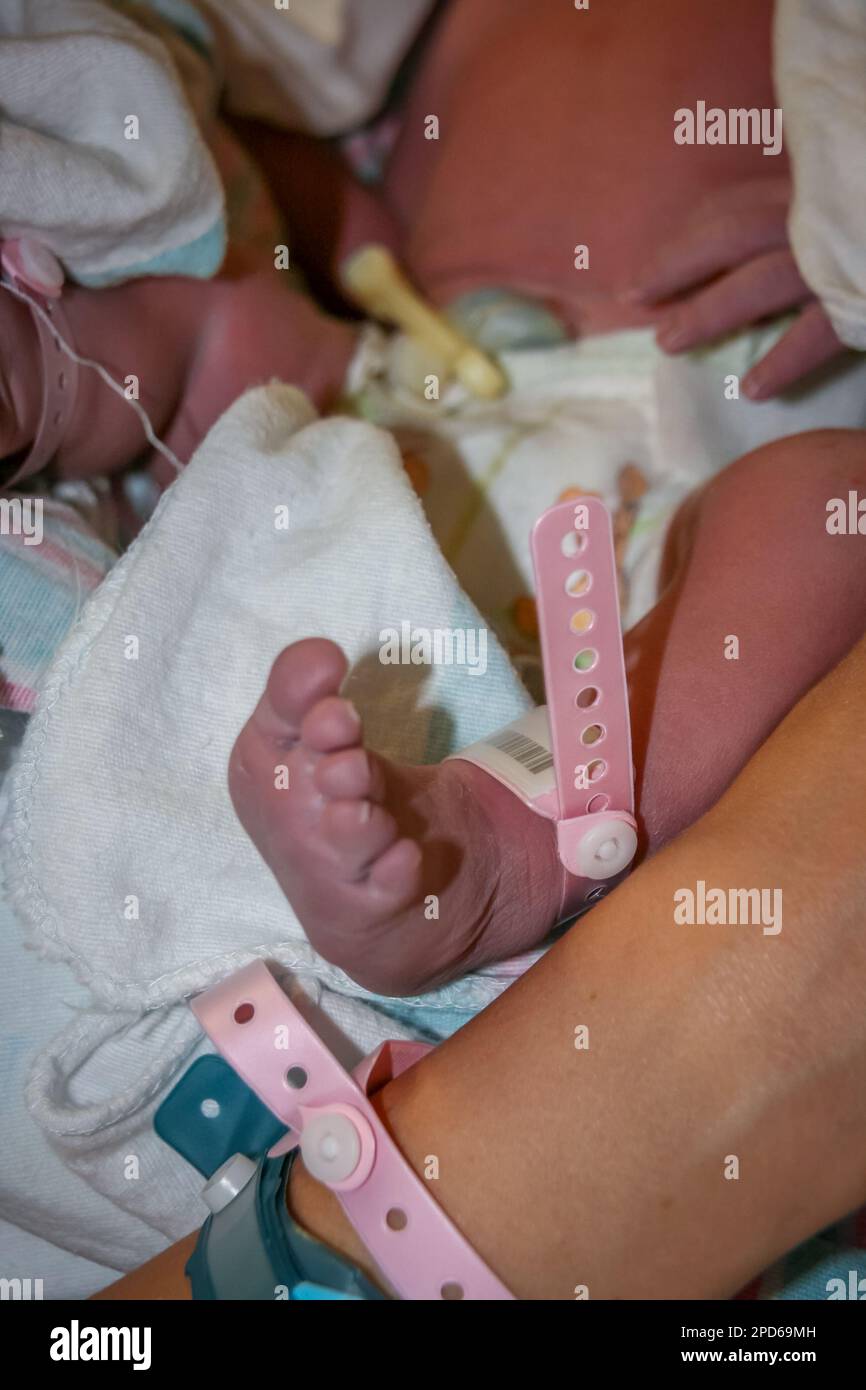 Foot of newborn baby wearing hospital leg band Stock Photo - Alamy