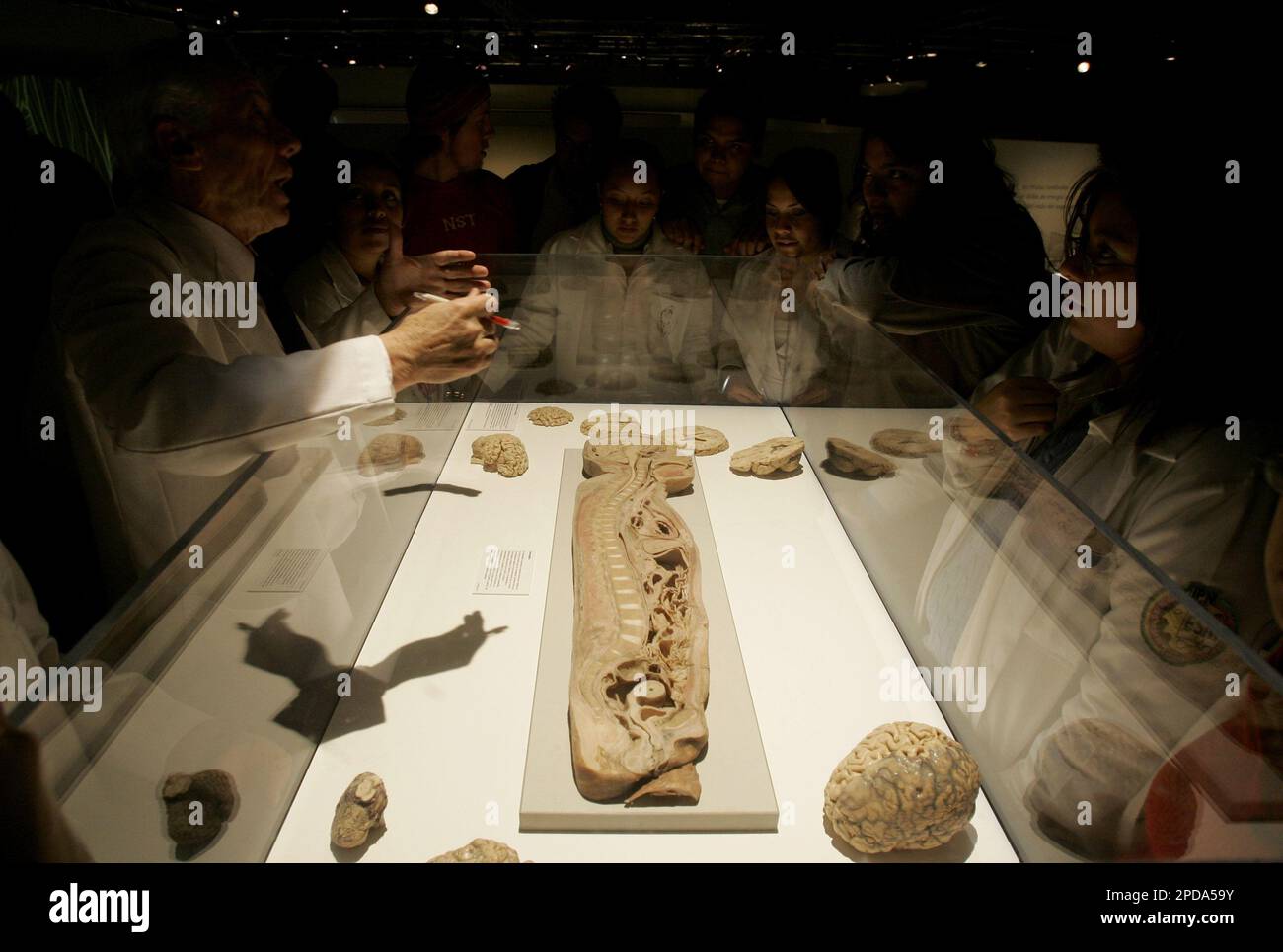 A group of visitors observes a disected cadaver during the exhibit ...