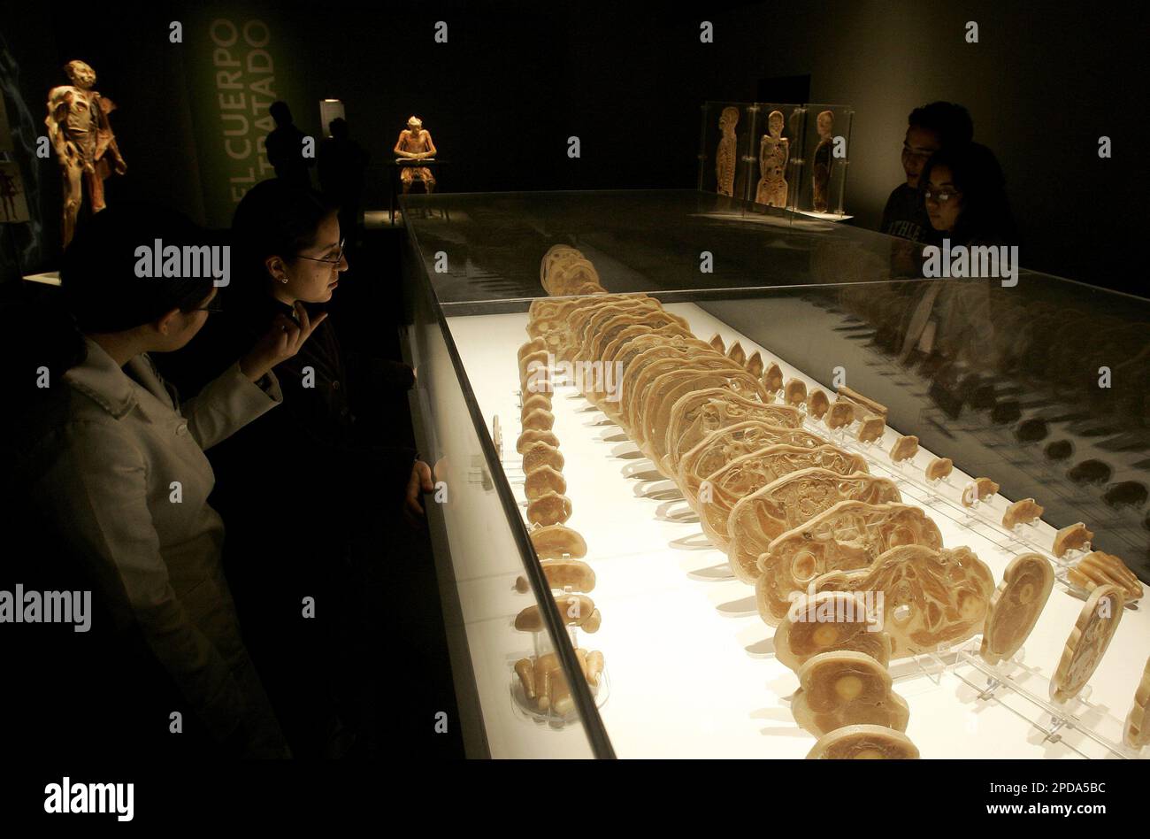 A group of visitors observes a disected cadaver during the exhibit ...