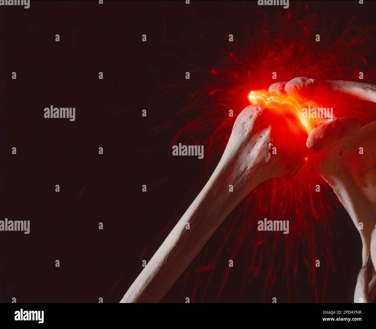 Computer-generated image of a human joint with flareup Stock Photo - Alamy