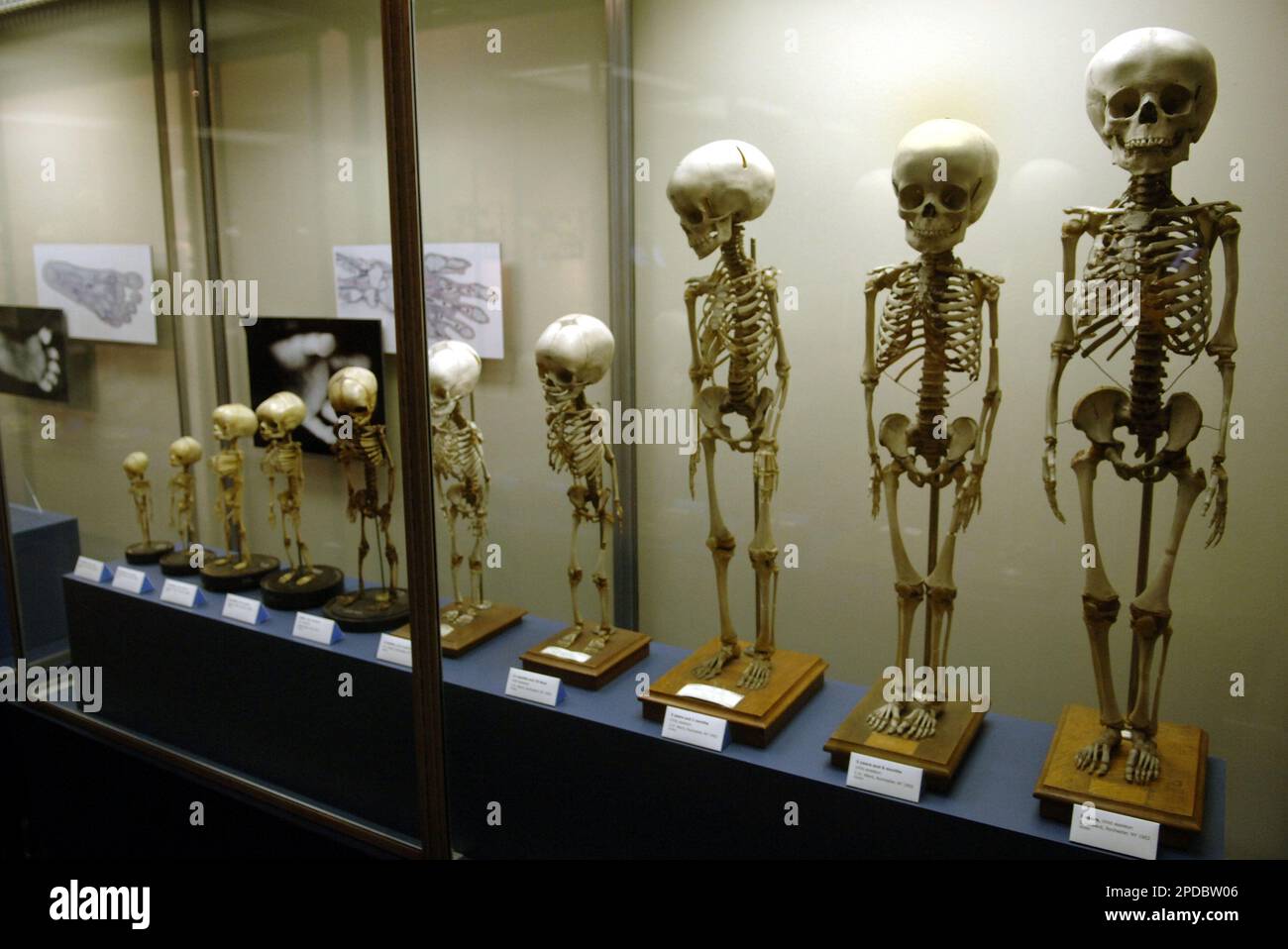 ** APN ADVANCE FOR Sunday, FEB. 26 **Skeletons, ranging from a four ...