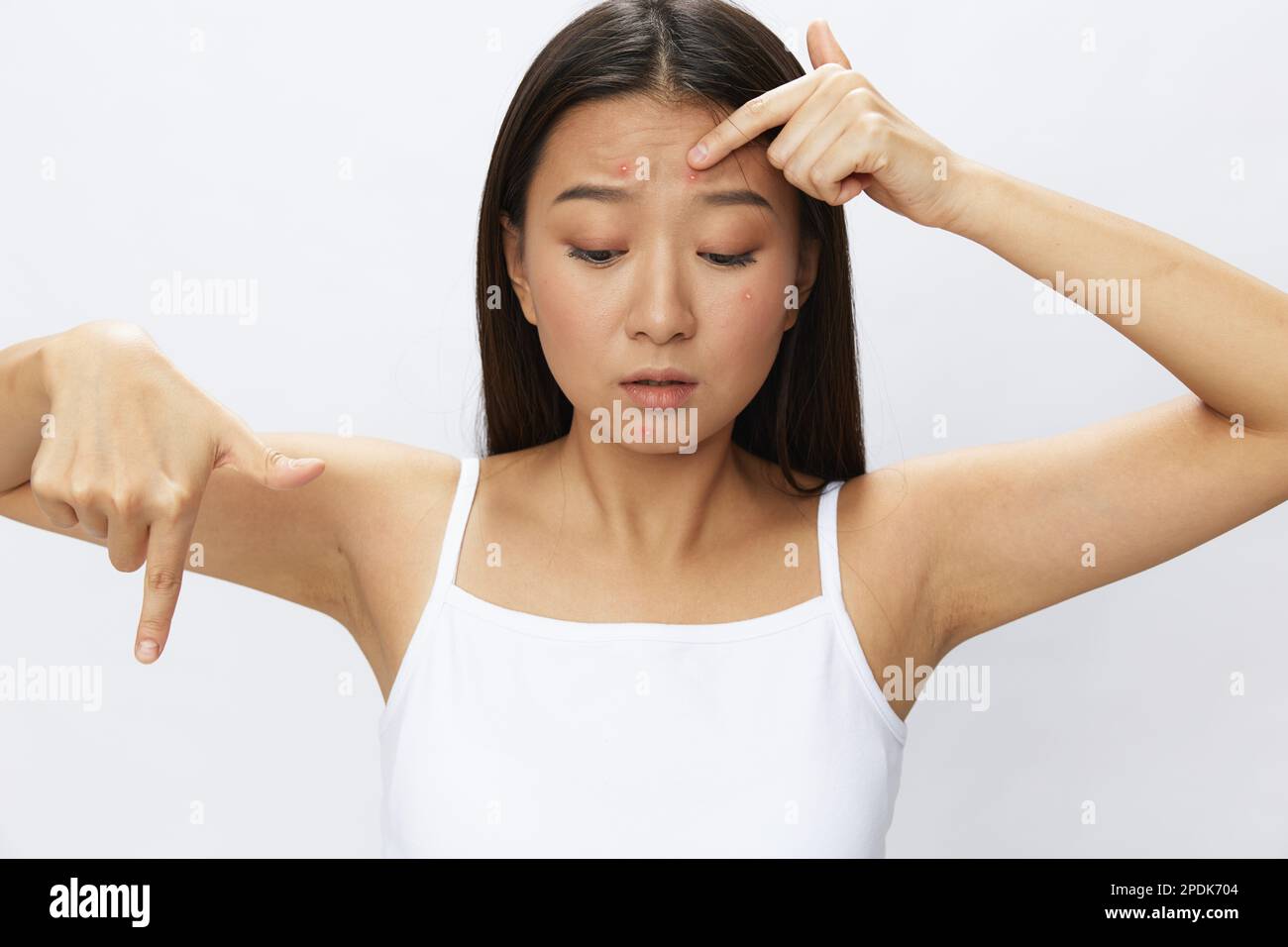 Asian woman facial skin problems, acne and inflammation, red rashes and ...