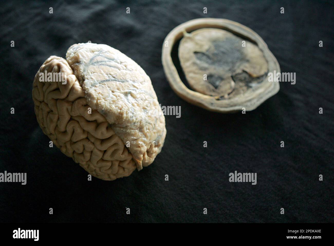 A human brain, left, and a cross section of a human brain which ...