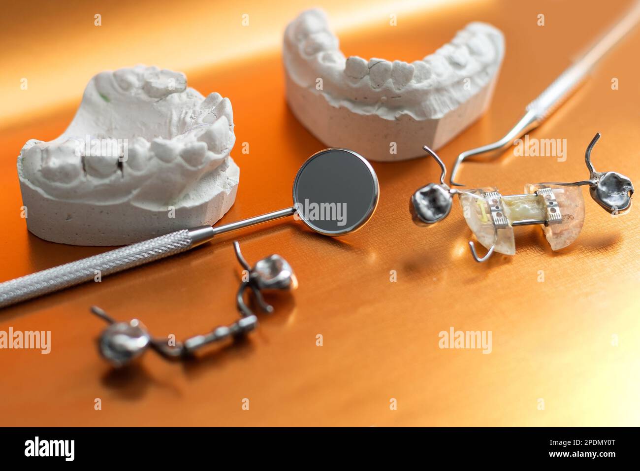 Dental models top view. Jaw models with different problems. Treatment ...