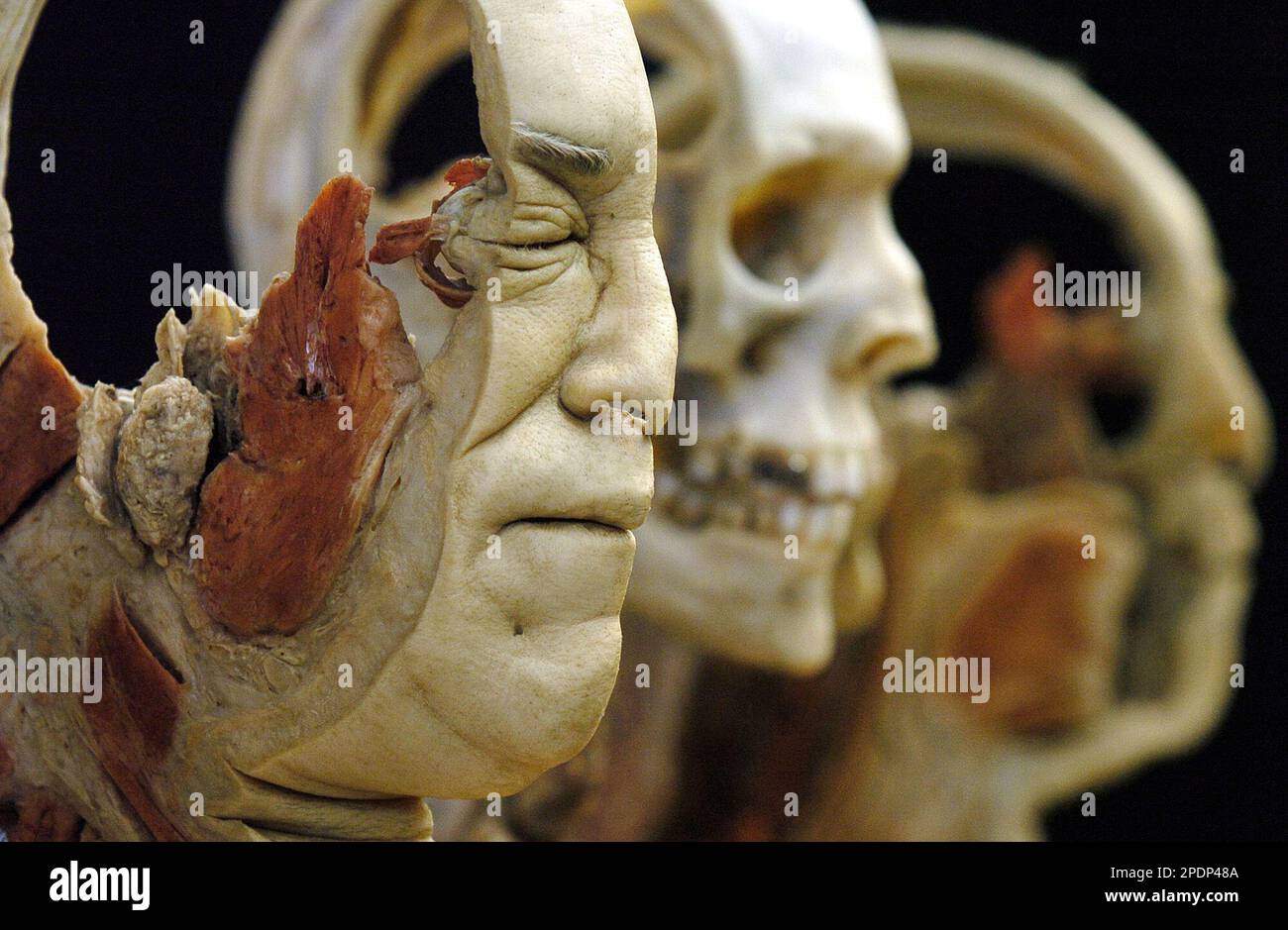 Human specimens, preserved through a process developed by German ...
