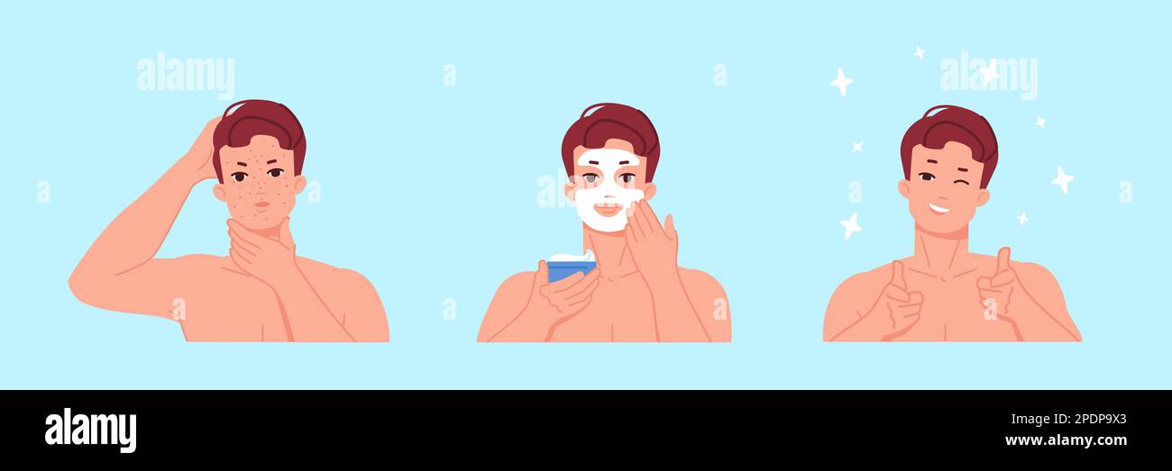 Boy acne treatment. Teenager with adolescence skin changes, men pimple ...