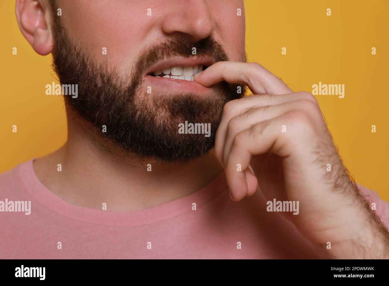 Man biting his nails on yellow background, closeup. Bad habit Stock ...