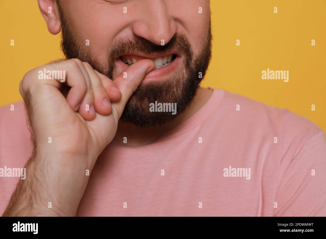 Man biting his nails on yellow background, closeup. Bad habit Stock ...