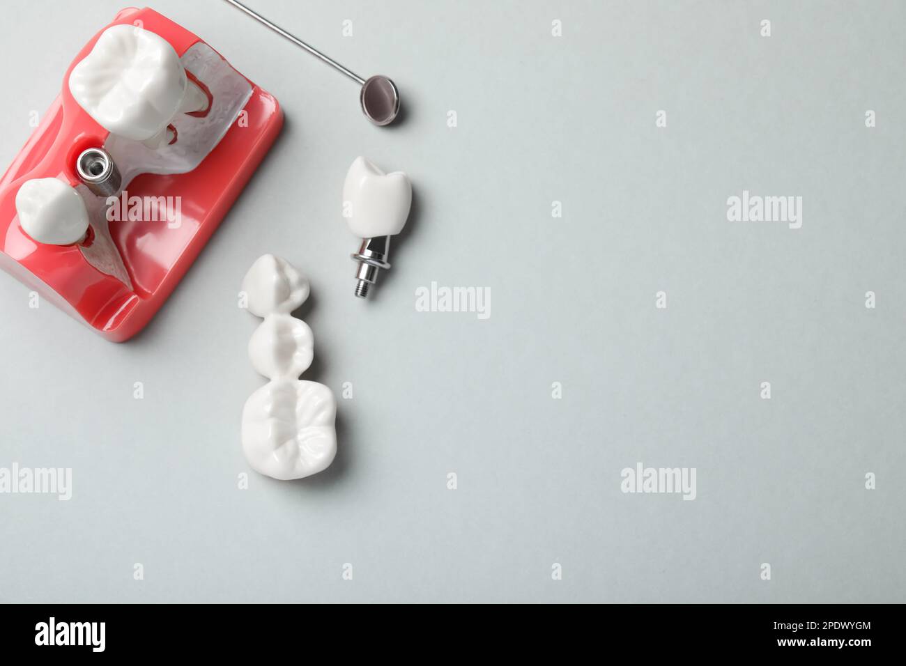 Educational model of gum with post between teeth, dental implant and ...
