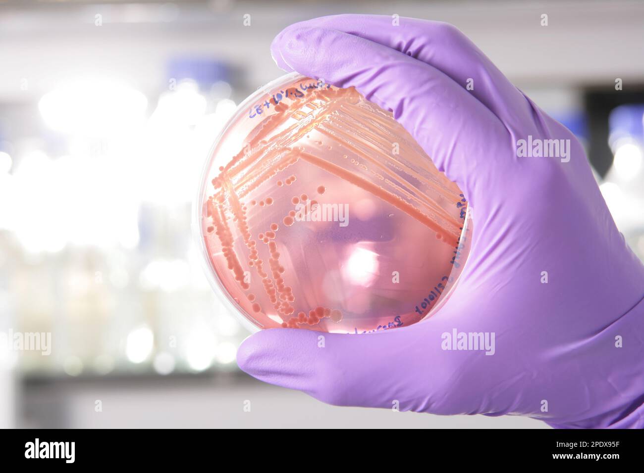 Lab culture dish hi-res stock photography and images - Alamy
