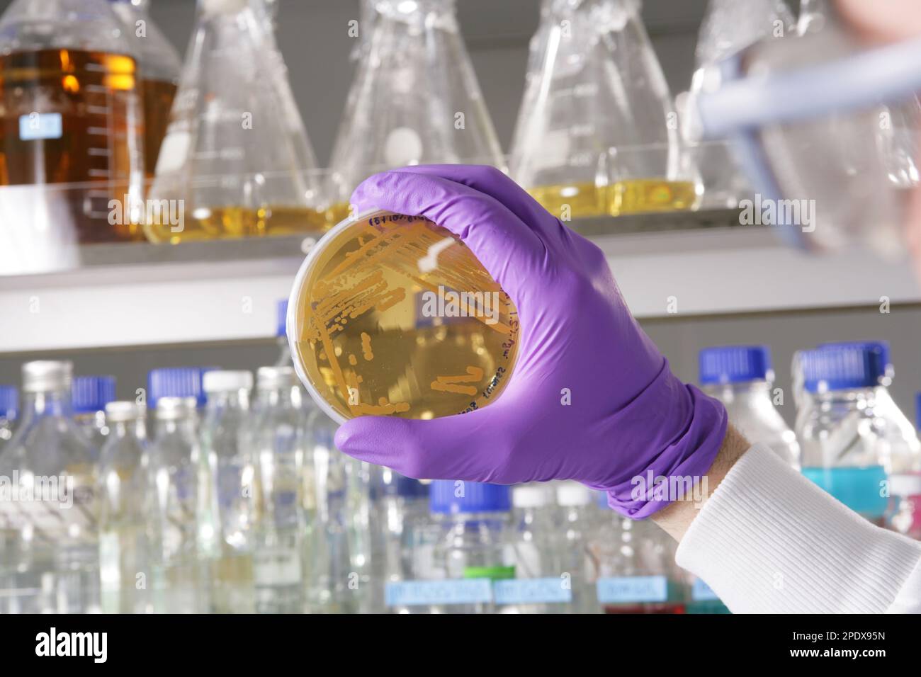Scientist examining a microbiological culture in a petri dish Stock ...