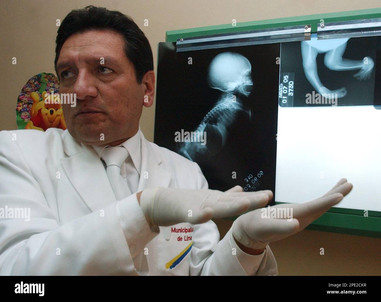 Peruvian doctor Luis Rubio, speaks about case of 1-month-old baby ...