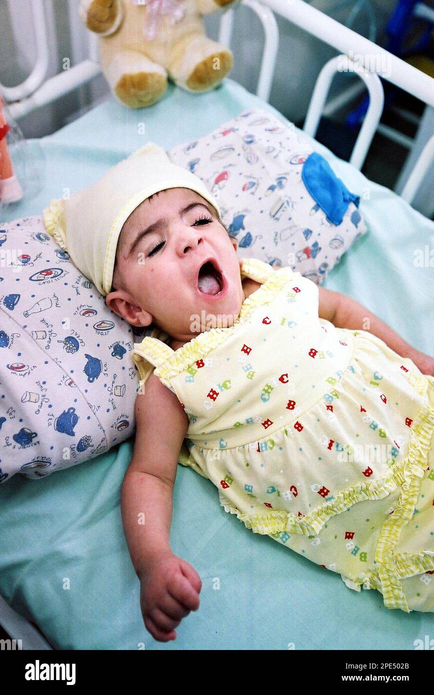 Egyptian baby girl Manar Maged, who was born March 30, 2004 with a rare ...
