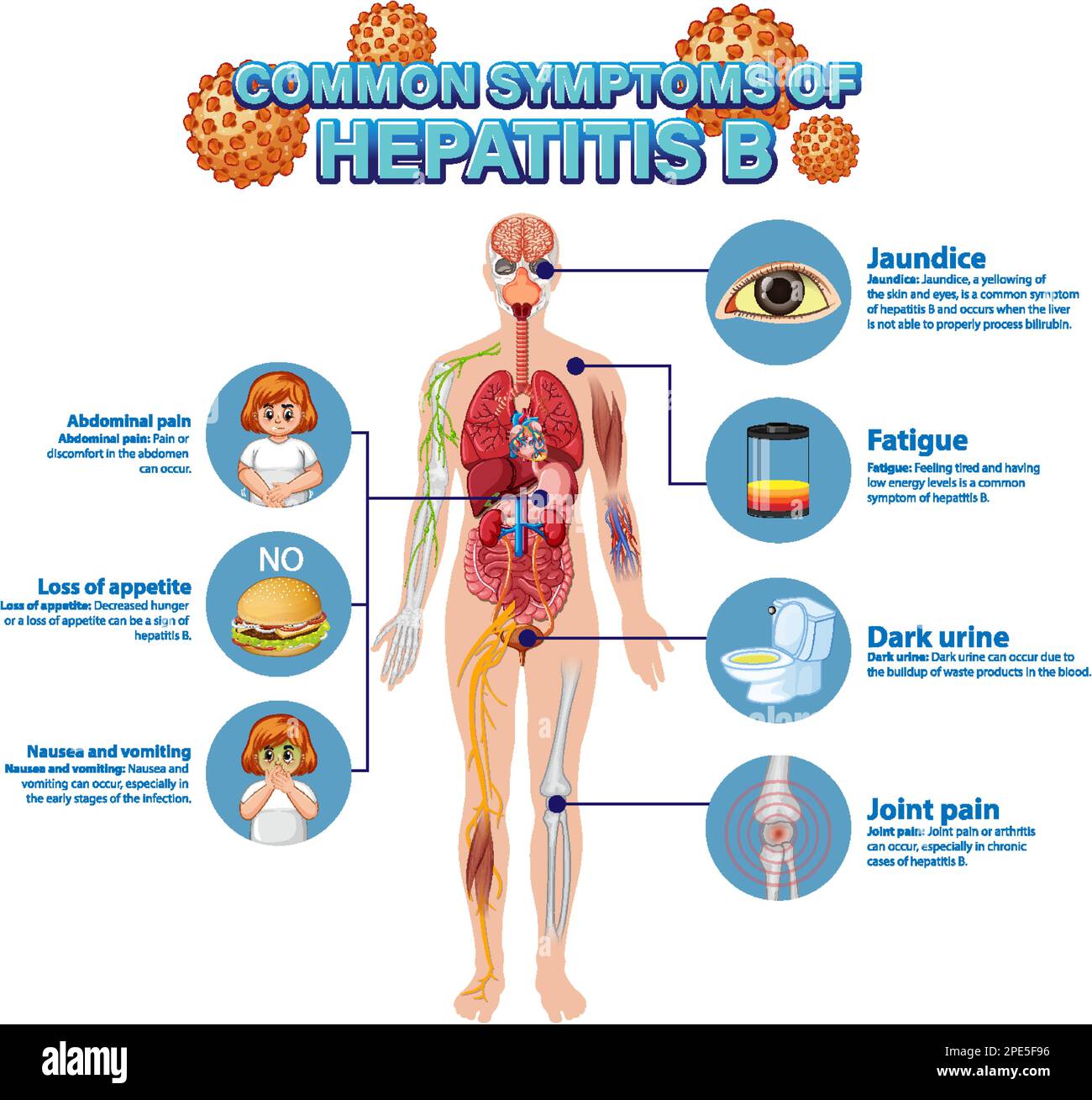 Informative poster of common symptoms Hepatitis B illustration Stock Vector Image & Art - Alamy